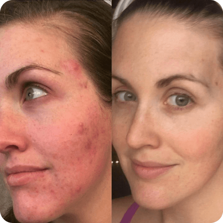 Miracle Balm - Beef Tallow Skin Care – Ancient Glow